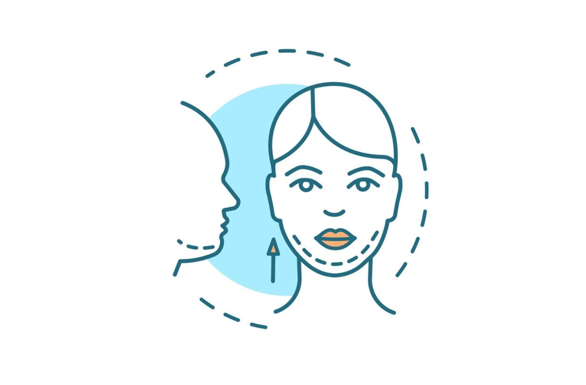 Neck Lift